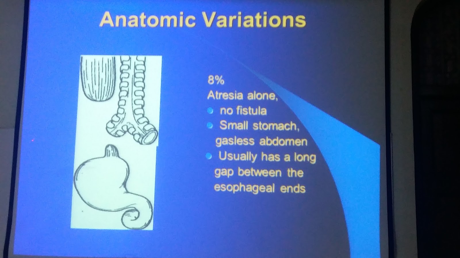 Lecture Slides; Paeds Surgery; Tracheoesophageal fistula n cong ...