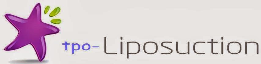 Liposuction
