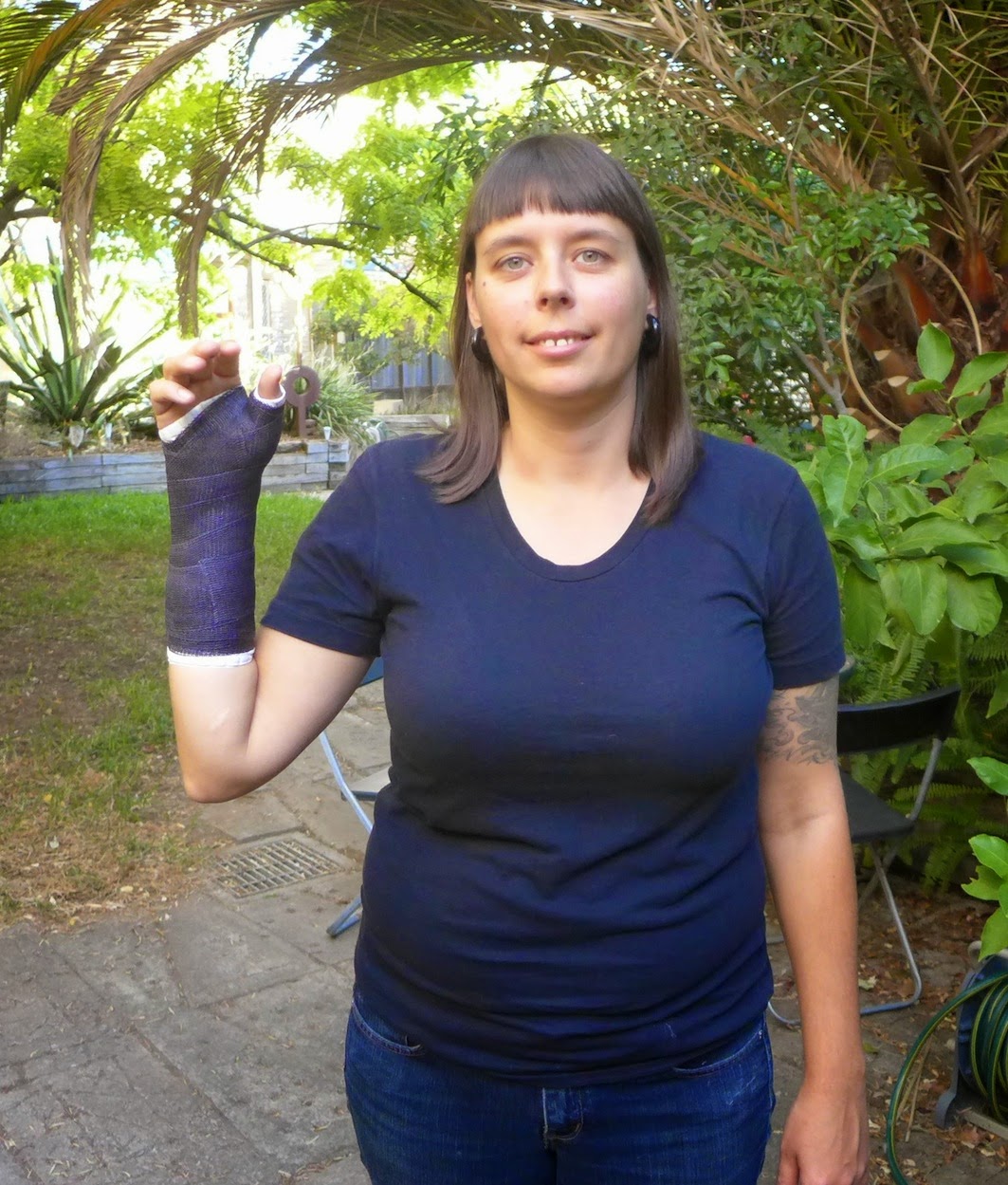 dark cloud blue sky: broken scaphoid