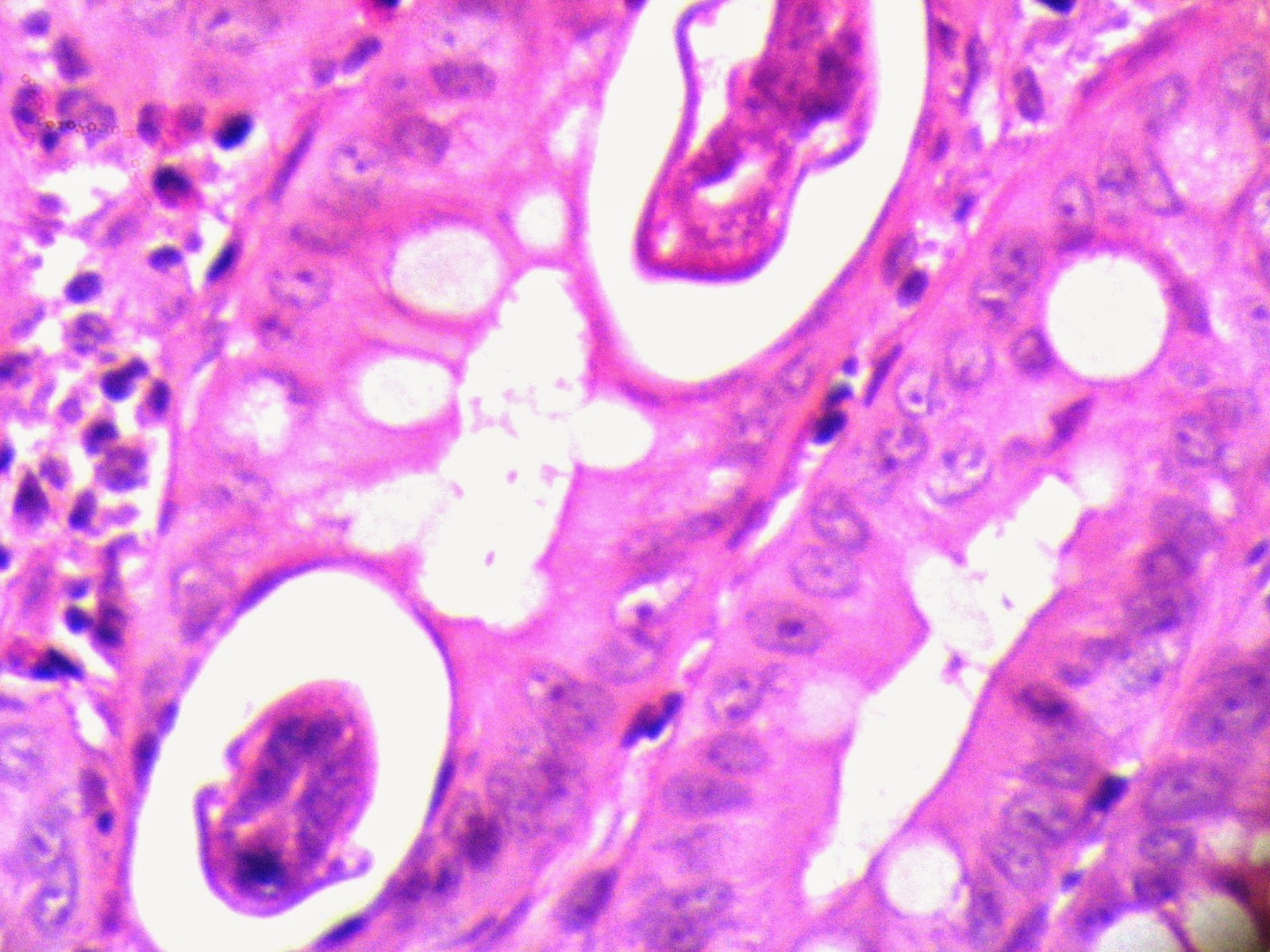 GASTROINTESTINAL AND LIVER HISTOLOGY PATHOLOGY ATLAS: DUODENUM ...