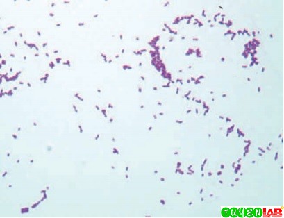 Listeria Gram