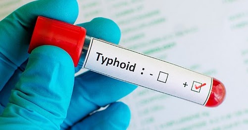 Inilah Gejala Sakit Tipes Yang Harus Anda Ketahui - SangPengajar.com