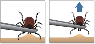 José Antonio Gelpi Méndez: Eritema migratorio en el diagnóstico de la Enfermedad de Lyme