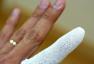 Jual GIPS Plester Perban | Harga Gips Patah Tulang - Toko Medis Jual ...