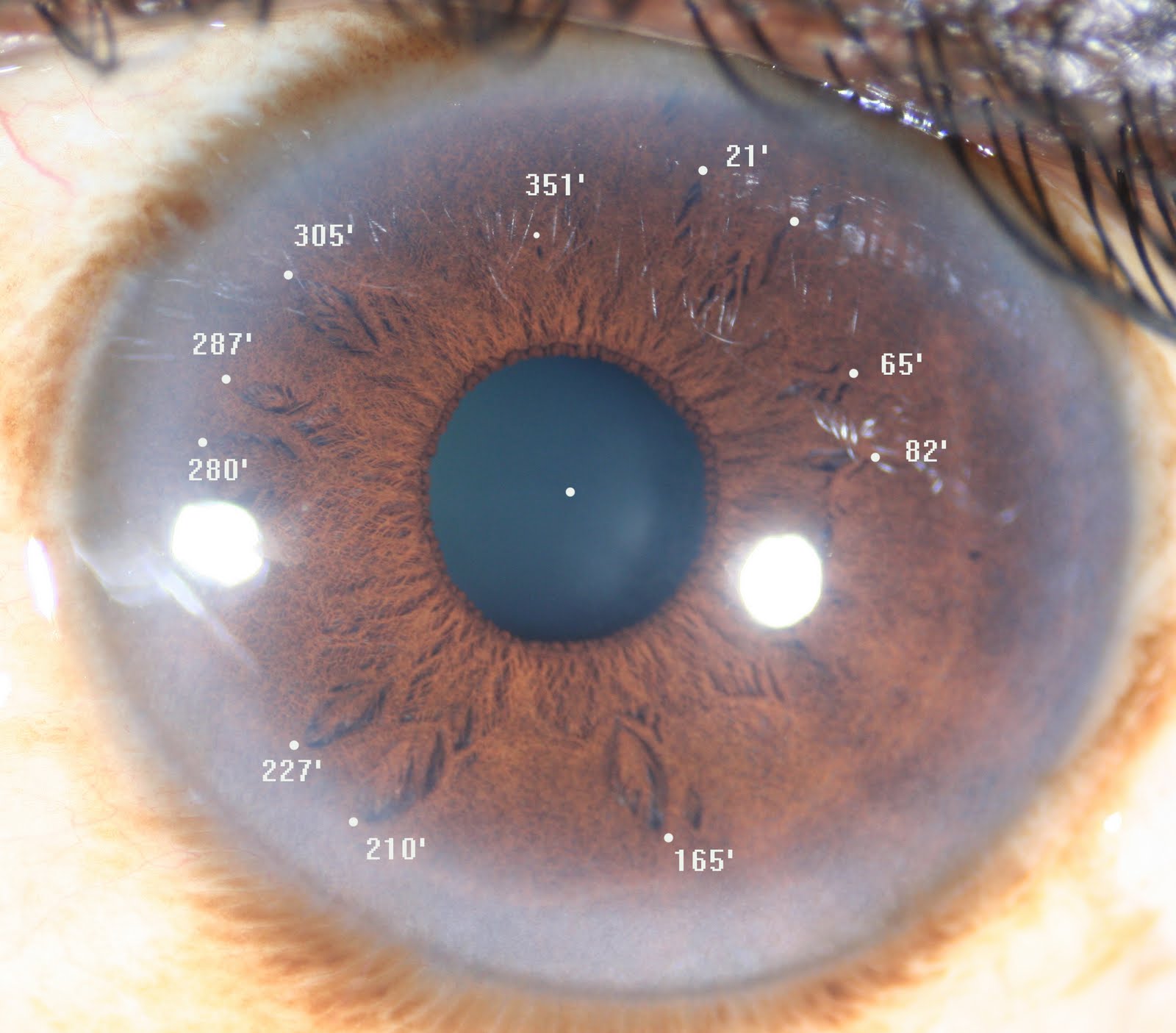 Modern & Multidimensional Iridology: Classical & Embryological - Inner ...