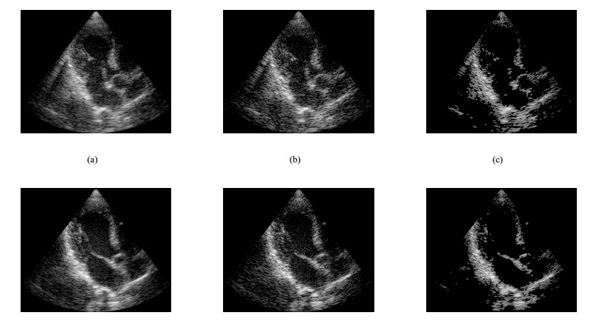 Nuit Blanche Fourier Domain Beamforming The Path To Compressed