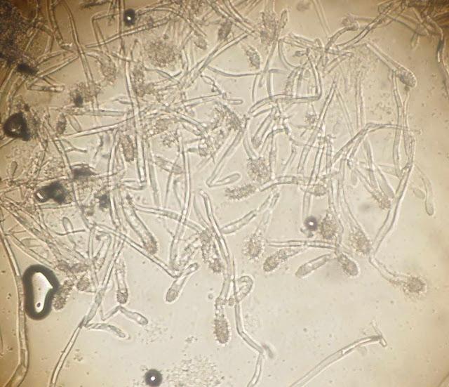 ATLAS MICOLOGIA: ASPERGILLUS CLAVATUS