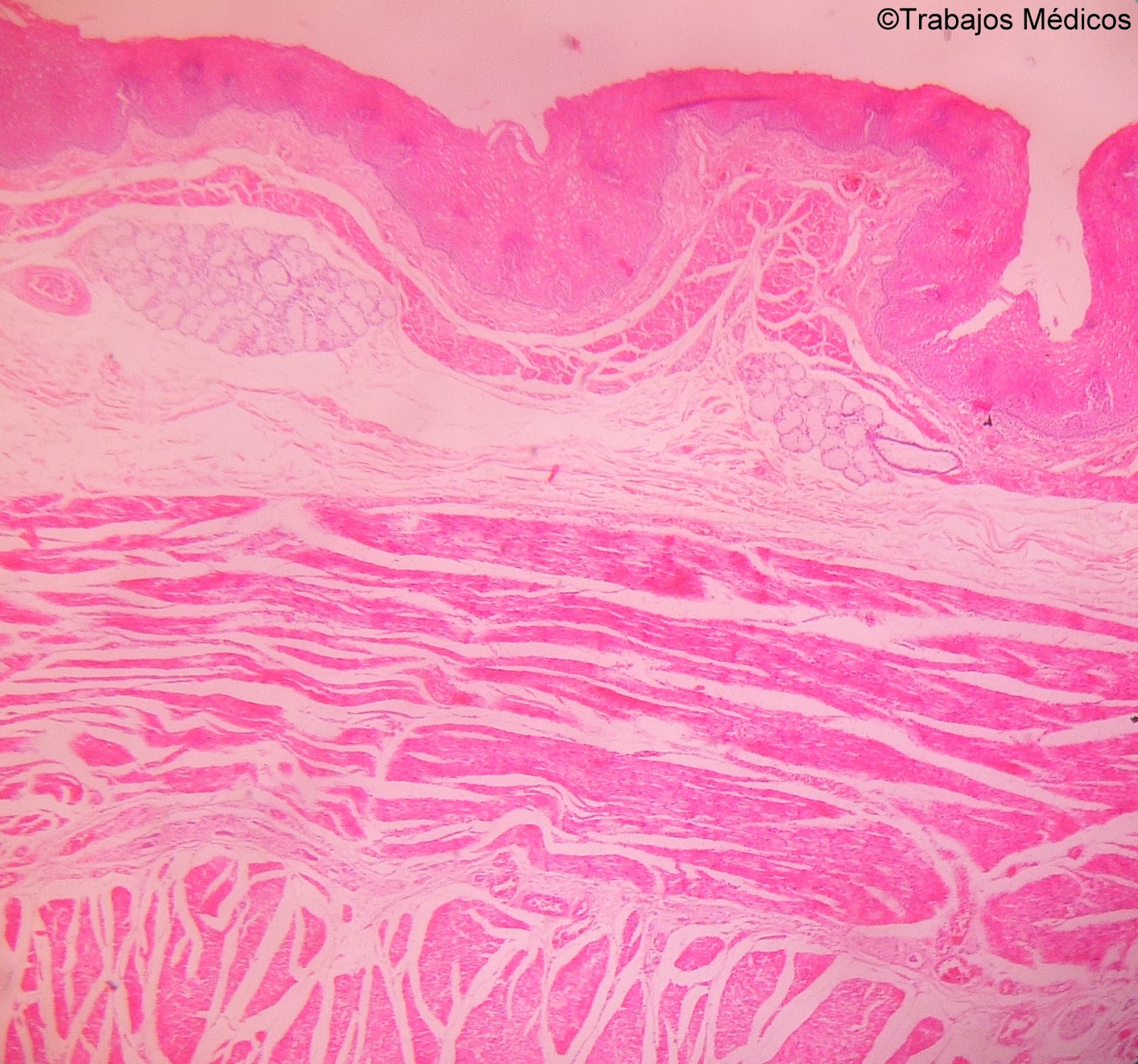 ESÓFAGO - PLACAS HISTOLÓGICAS