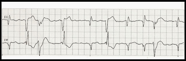 Practice EKG Rhythm Strips 223