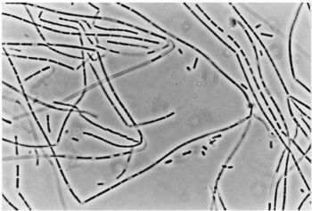 Education Science : Sphaerotilus natans pada Pengolahan Limbah