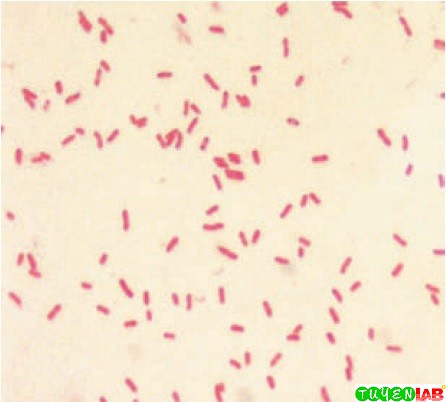 [Microbiology] Atlas of Agents of Bioterror | Free Medical Atlas