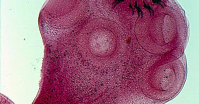 Parasitología : TENIASIS