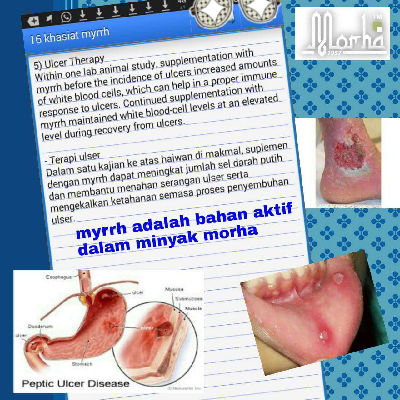 Dah ada Minyak Morha?: Khasiat unik myrrh