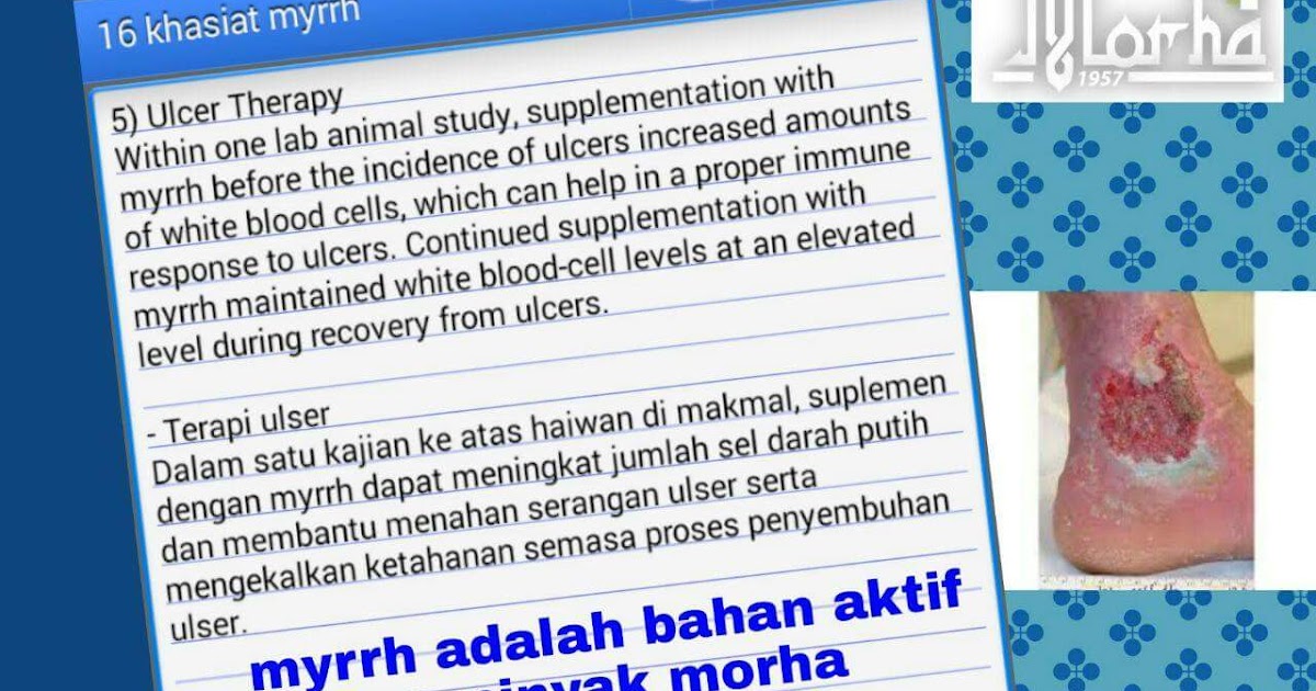 Dah ada Minyak Morha?: Khasiat unik myrrh