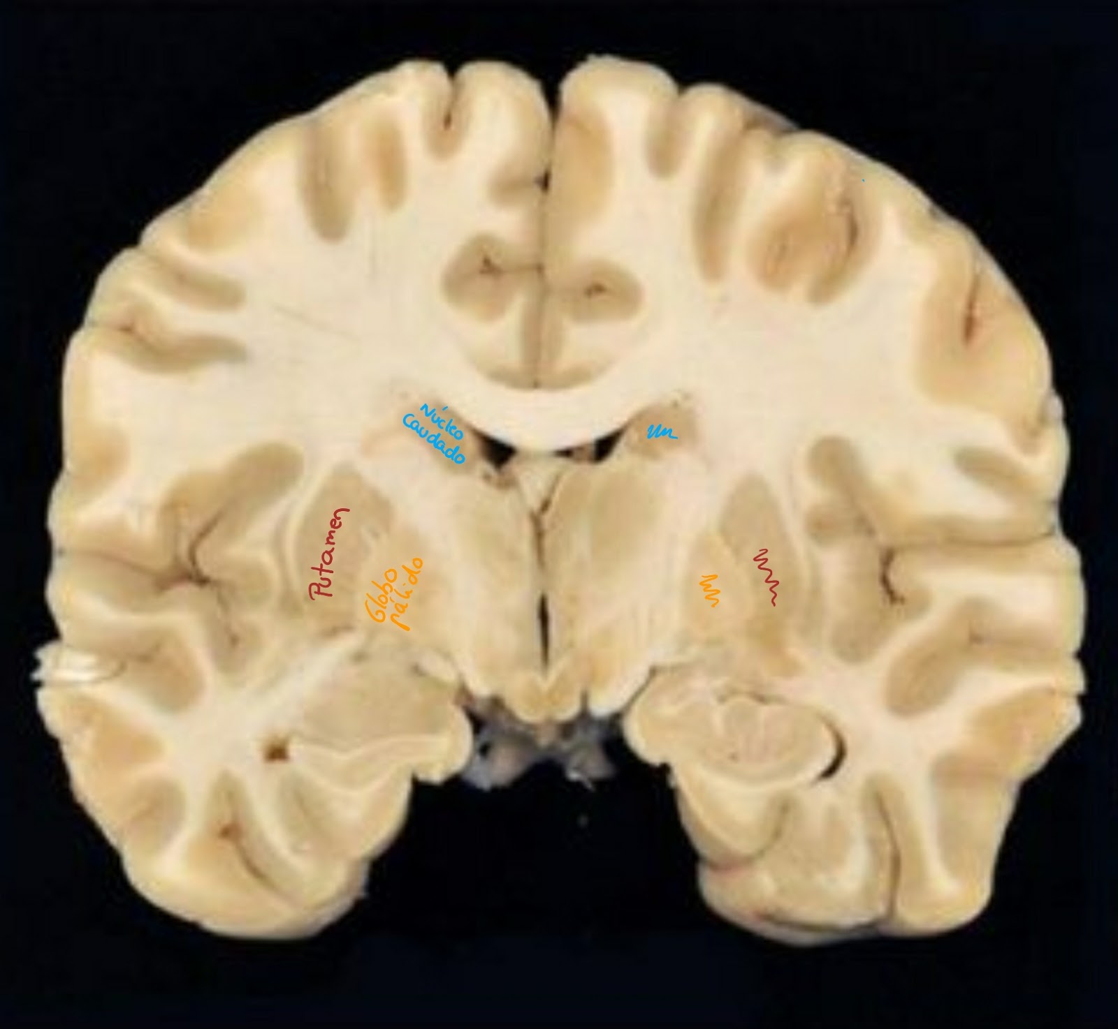 Un paso más cerca del conocimiento (Atlas de neuroanatomía).: ENCÉFALO ...