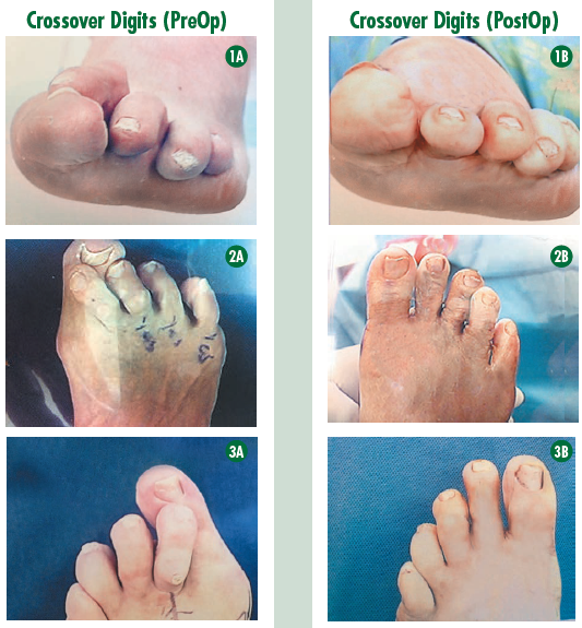Broward County's Podiatric Experts: June 2019