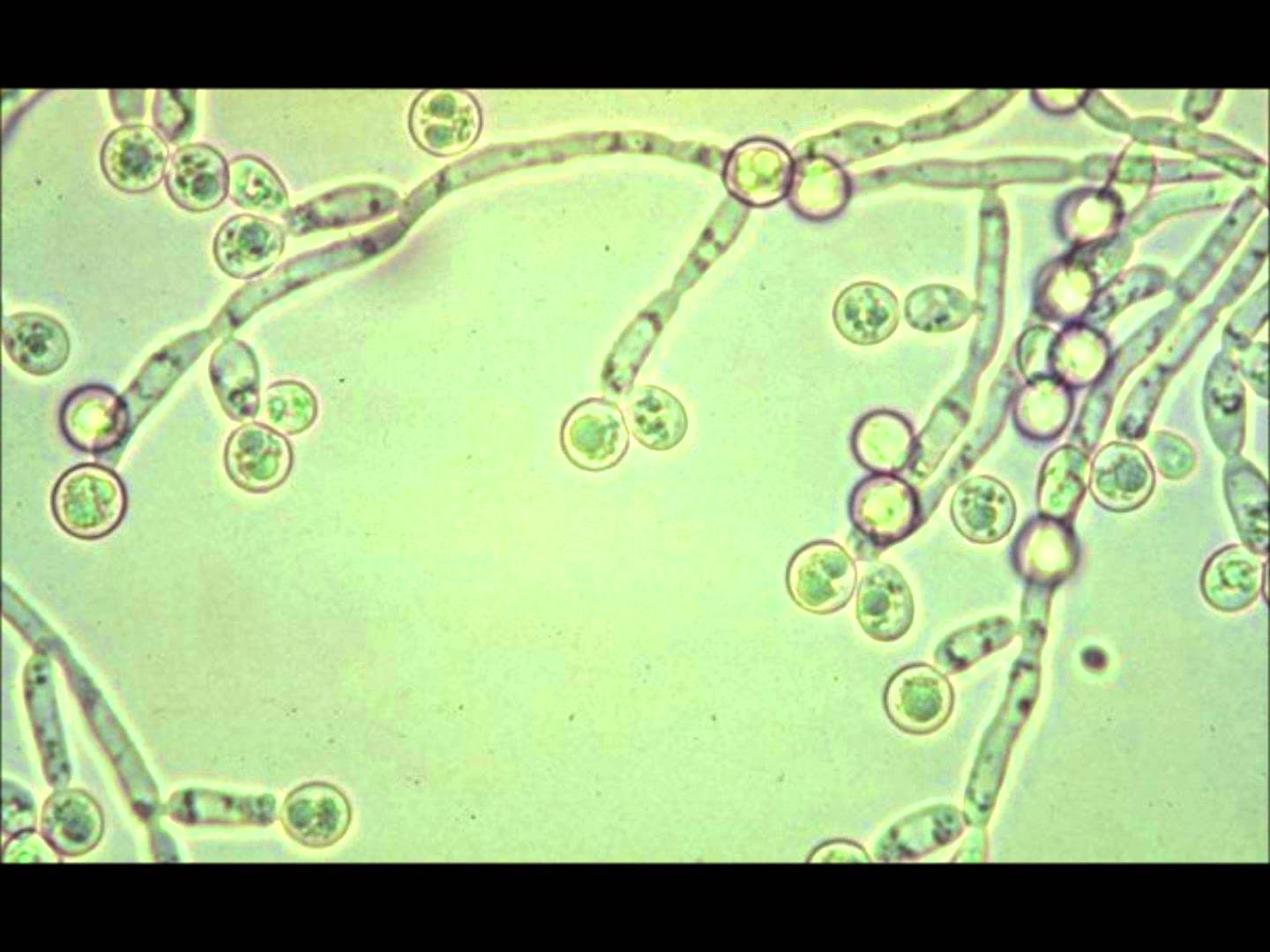 MICROBIOLOGÍA MÉDICA EN COLOMBIA: Candida Albicans