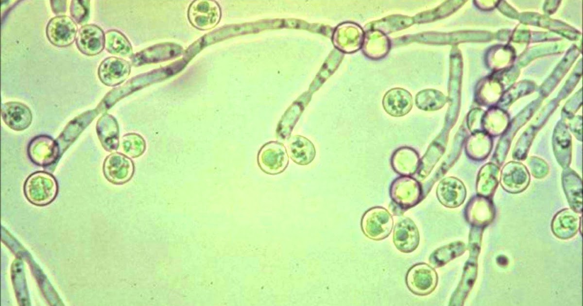 MICROBIOLOGÍA MÉDICA EN COLOMBIA: Candida Albicans