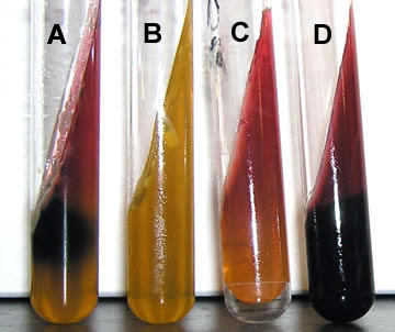 Hydrogen Sulfide (H2S) Production Test - Microbiology Lab Notes