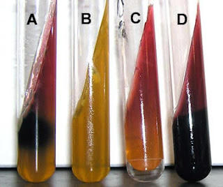 Hydrogen Sulfide (H2S) Production Test - Microbiology Lab Notes