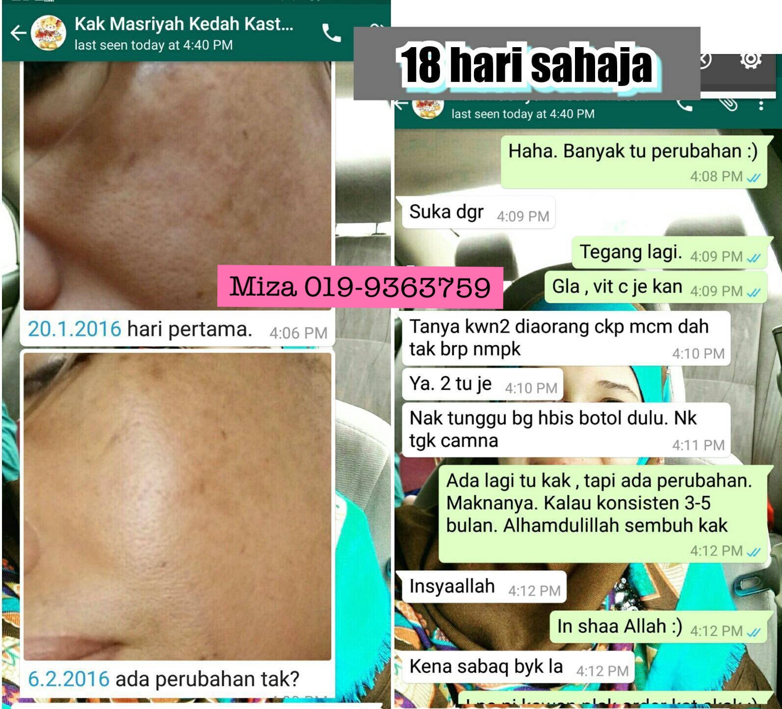 Cara Hilangkan Jeragat Cepat Dan Mudah - Wajib Cuba Set Jeragat Paling ...