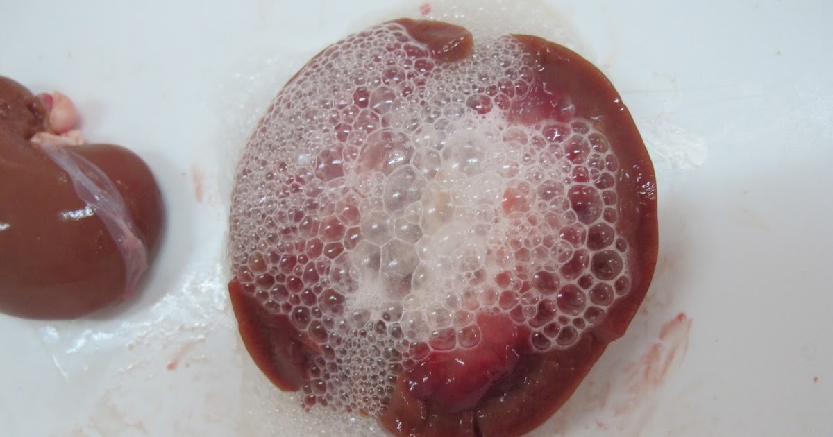 BiG 15-16: Dissecció de ronyons a 1r batx A