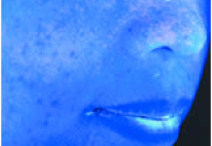 FISIOTERAPIA, ESTÉTICA E BELEZA: DERMAVIEW