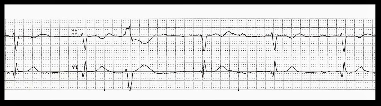 EKG Rhythm Quiz 248