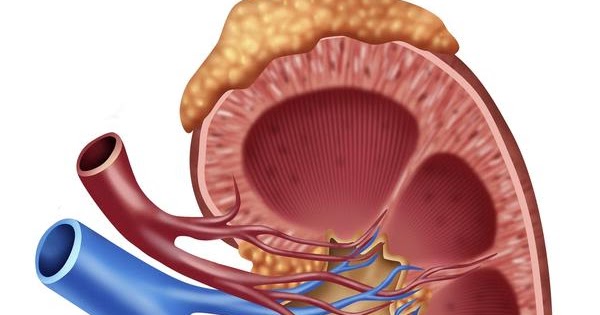 treatment for kidney disease: Difference between a Kidney Cyst and a ...