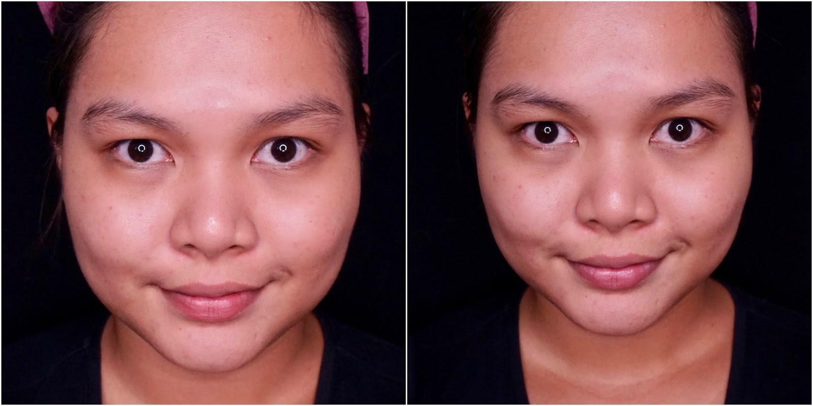 Crazy Skin Lifting Mask That Lifts Skin In Minutes!