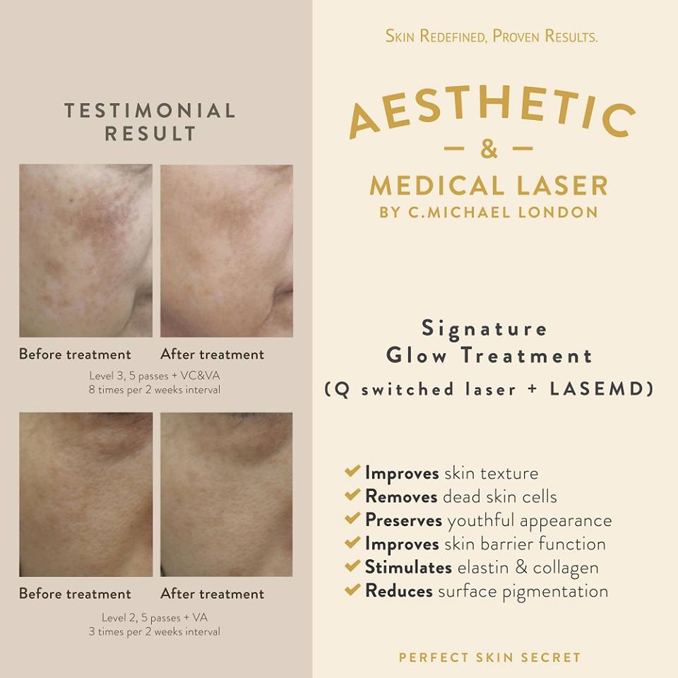 C.Michael Aesthetic Laser Facial Treatment: Signature Glow Treatment ...