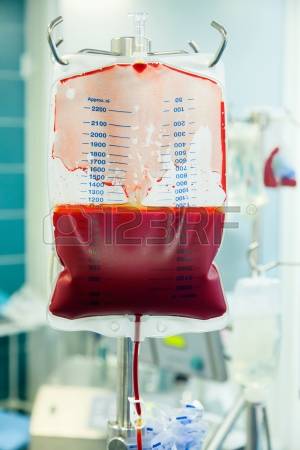 SYNDROME IMMUNITAIRE DEFICIENT ACQUIS: SYNDROME IMMUNITAIRE DEFICIENT ...