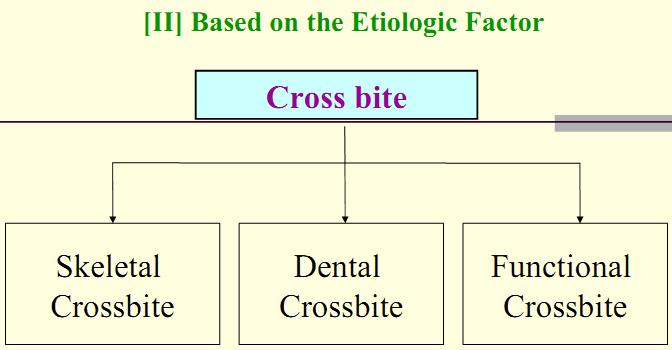Dentistry lectures for MFDS/MJDF/NBDE/ORE: Etiology, Classification ...