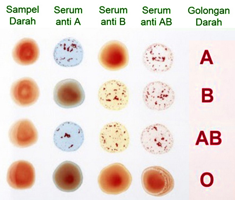 Macam-macam Penggolongan Darah, Materi Lengkap - SIAP UJIAN