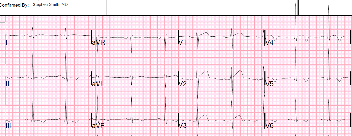 Dr. Smith's ECG Blog