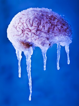 Ice Cream Headache or Sphenopalatine Ganglioneuralgia ~ Dr Impo
