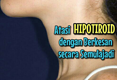 Cara Atasi Hipotiroid dengan Berkesan secara Semulajadi - Serimuslimah ...