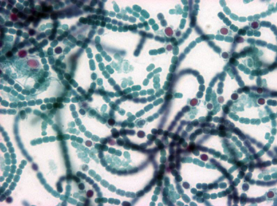 Los seres vivos y su fantástica clasificación: Procariotas: bacterias ...