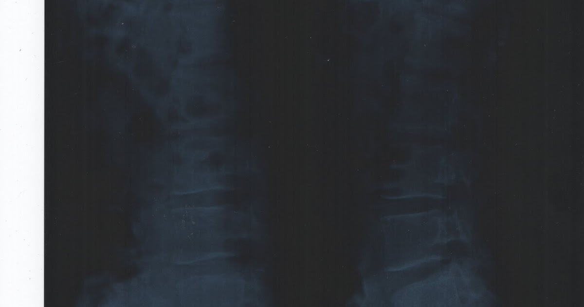 Scanning X-Ray Films