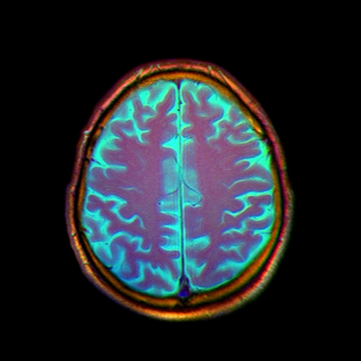 Nevit's blog: Color MRI of the Brain