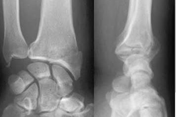 Un médecin du sport vous informe: 06.23.2013