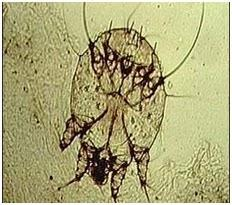 Membangun Kesehatan Hewan Untuk Kesehatan Manusia: PENYAKIT SCABIES ...