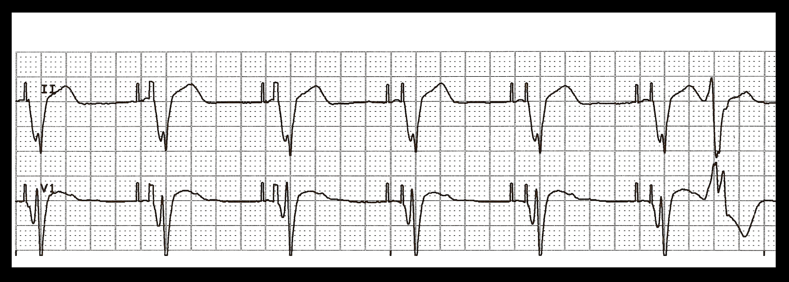 Practice EKG Strips 320