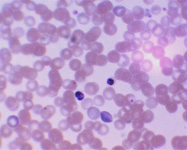 Taxas Biológicas : Protozoarios