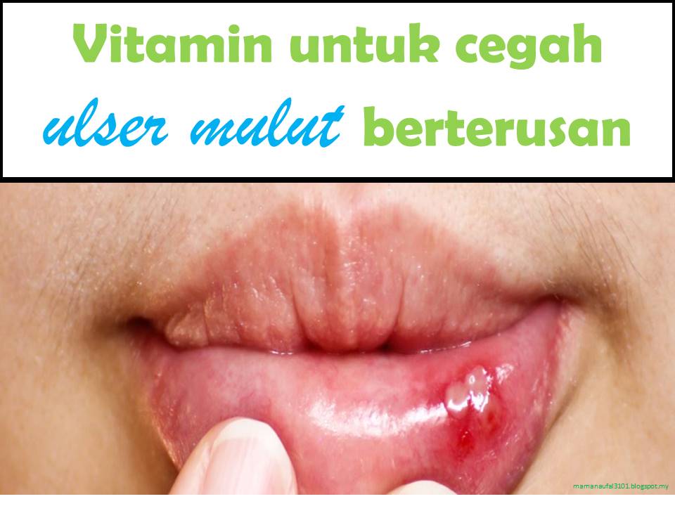 Farah Hanim: VITAMIN UNTUK CEGAH ULSER MULUT BERTERUSAN