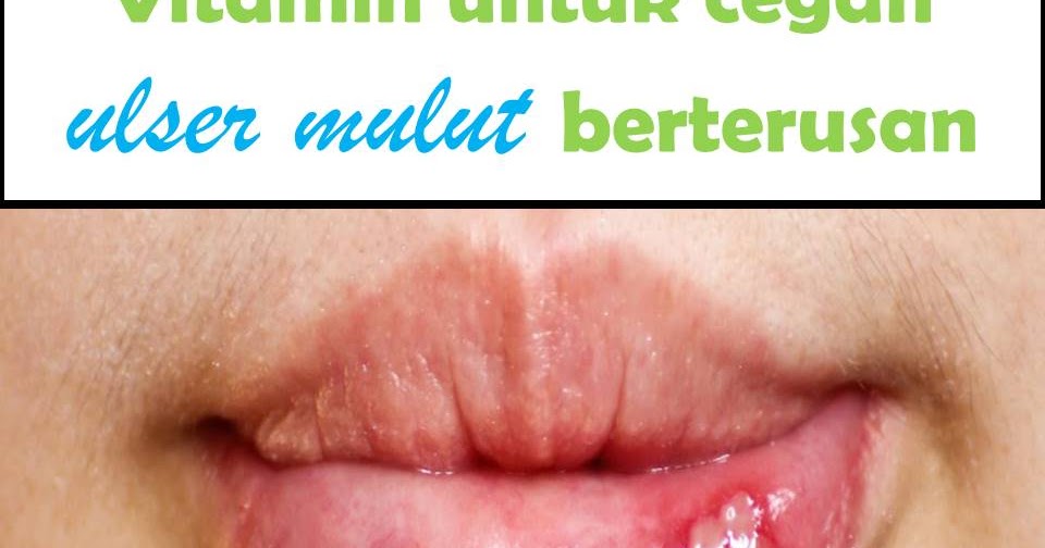Farah Hanim: VITAMIN UNTUK CEGAH ULSER MULUT BERTERUSAN