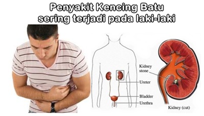 Pengobatan Herbal Kencing Batu - Cara Mengobati Penyakit Alami