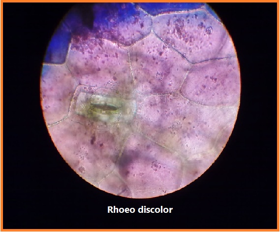 BIOLOGI GONZAGA: OSMOSIS - KRENASI - PLASMOLISIS