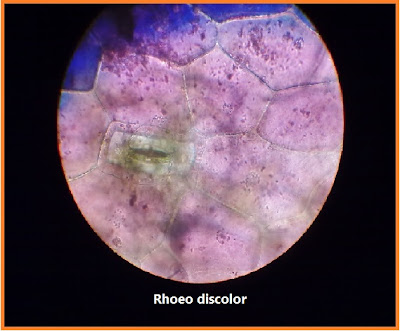 BIOLOGI GONZAGA: OSMOSIS - KRENASI - PLASMOLISIS