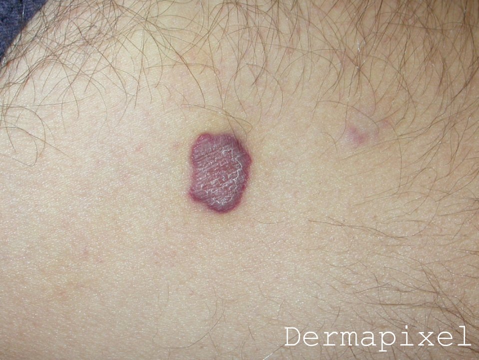Dermapixel: 2012
